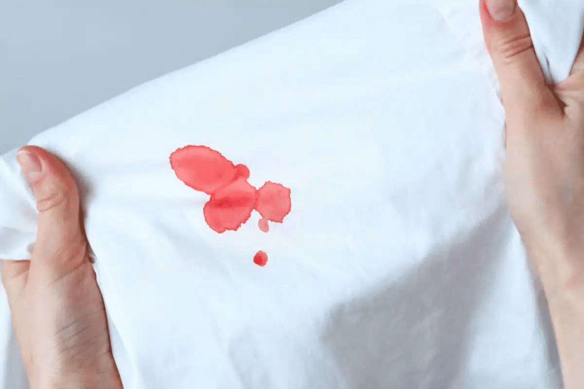 Removing blood stains – here's how - Practical Tips